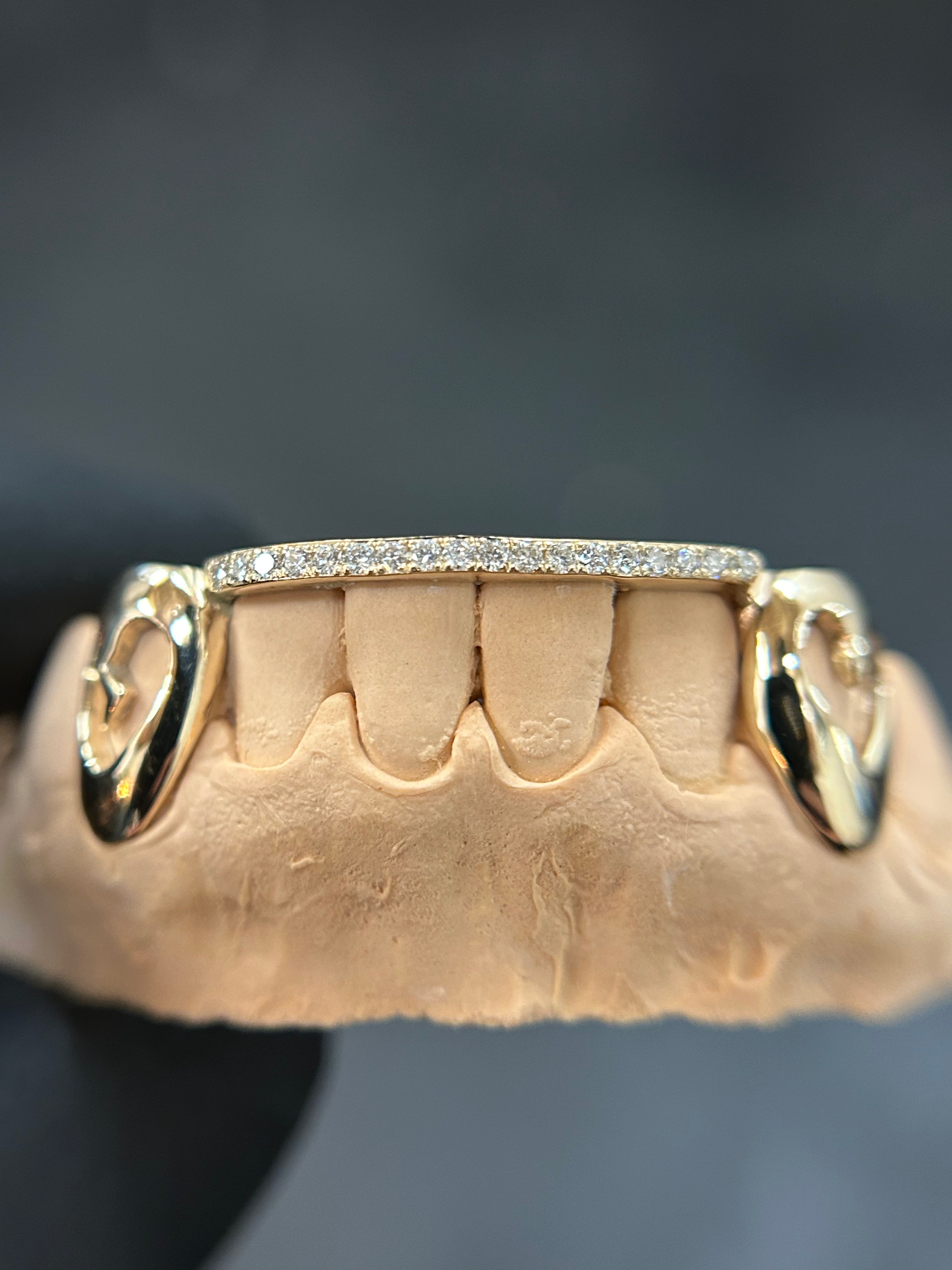 Bridges & Braces – LOUD MOUTH LDN