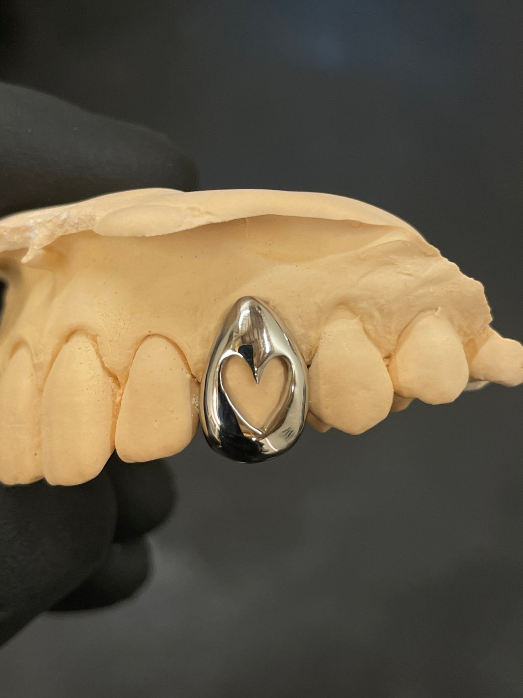Custom Grillz London | Gold & Silver Grillz – LOUD MOUTH LDN