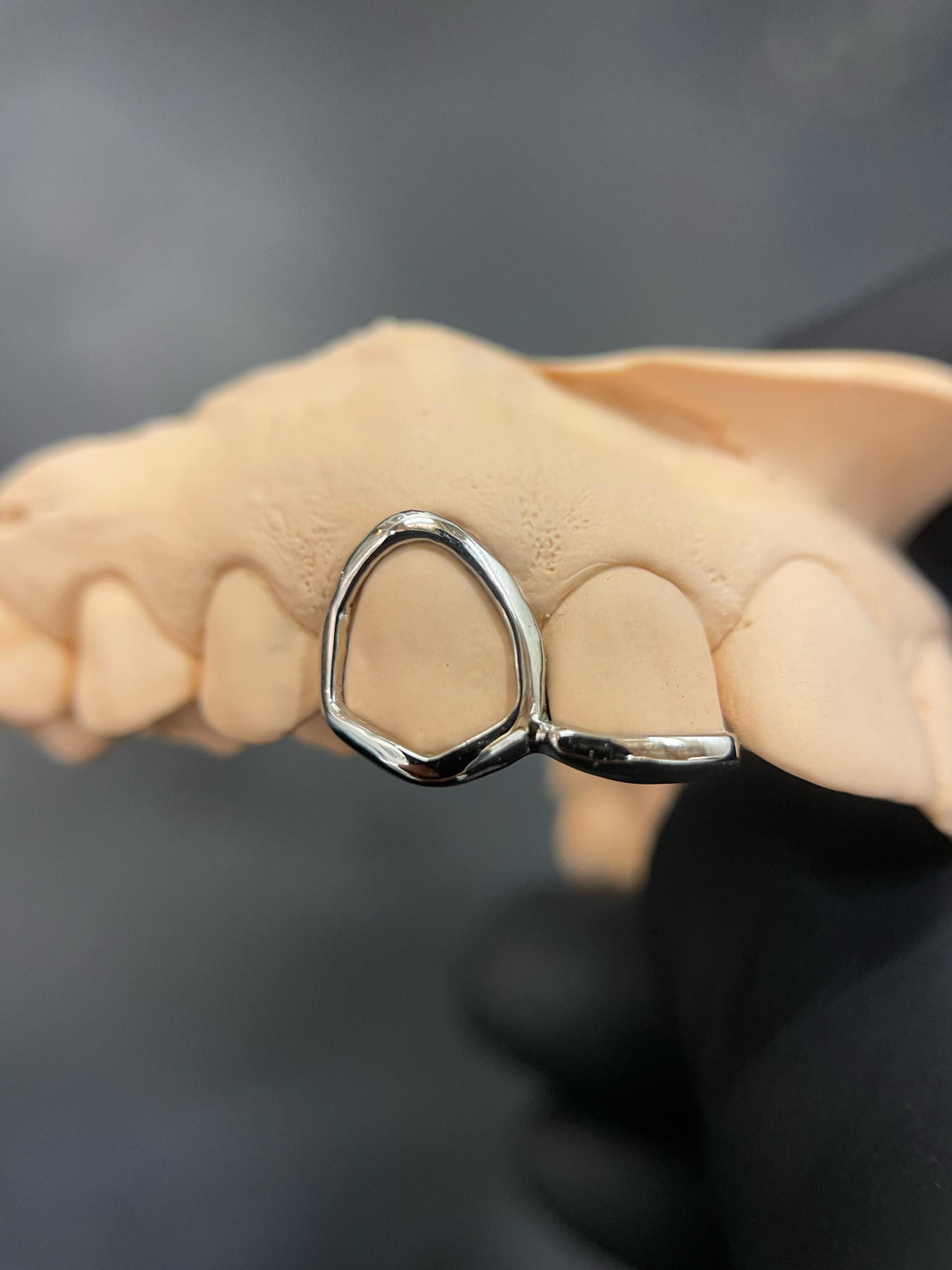 Custom Grillz London | Gold & Silver Grillz – LOUD MOUTH LDN
