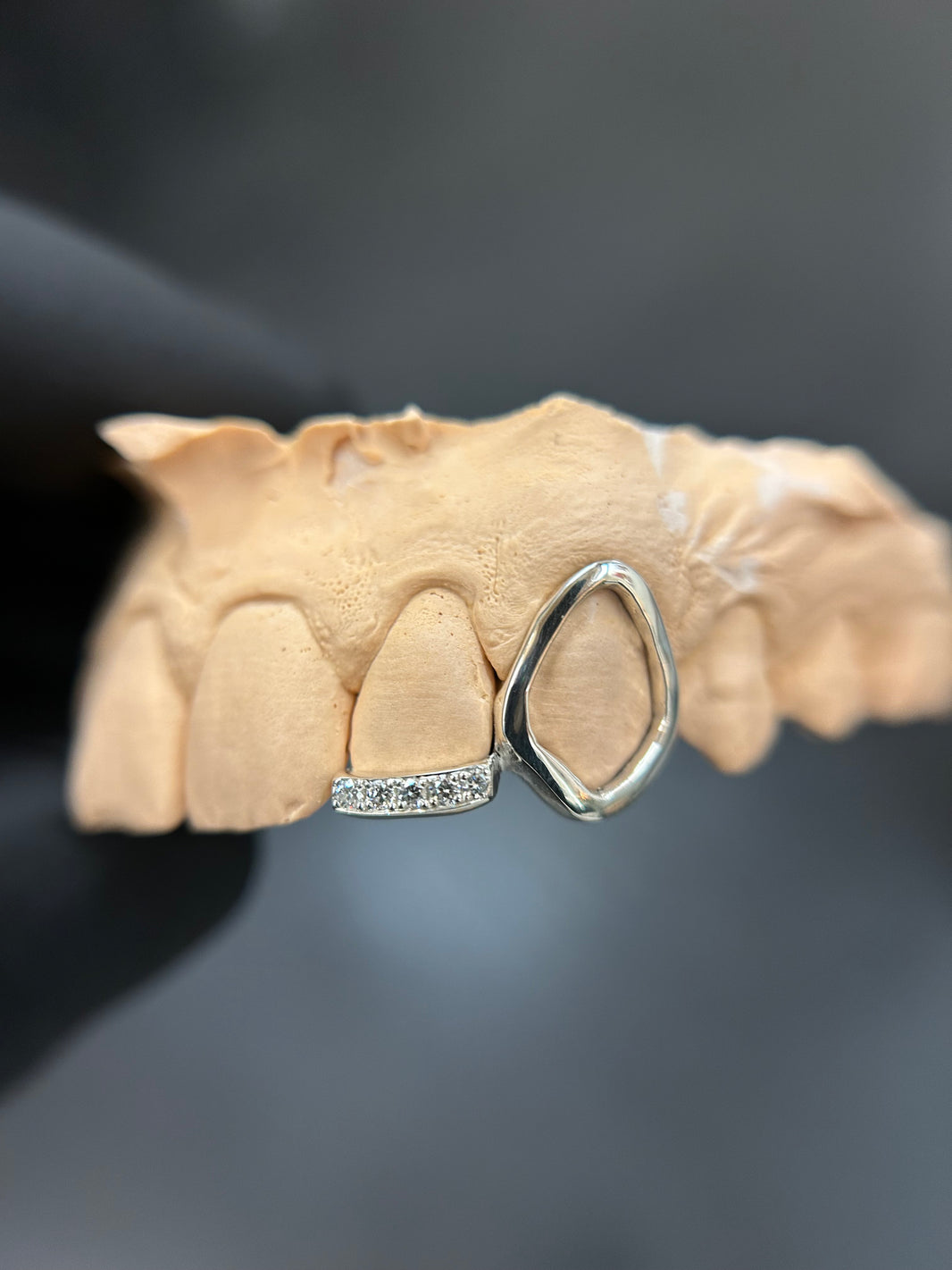 Custom Grillz London | Gold & Silver Grillz – LOUD MOUTH LDN