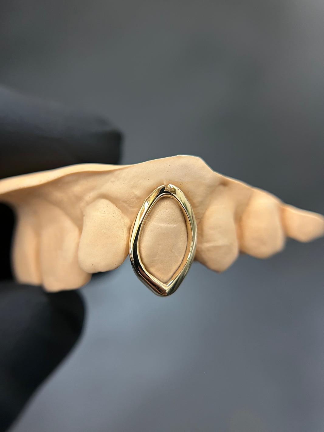 Custom Grillz London | Gold & Silver Grillz – LOUD MOUTH LDN