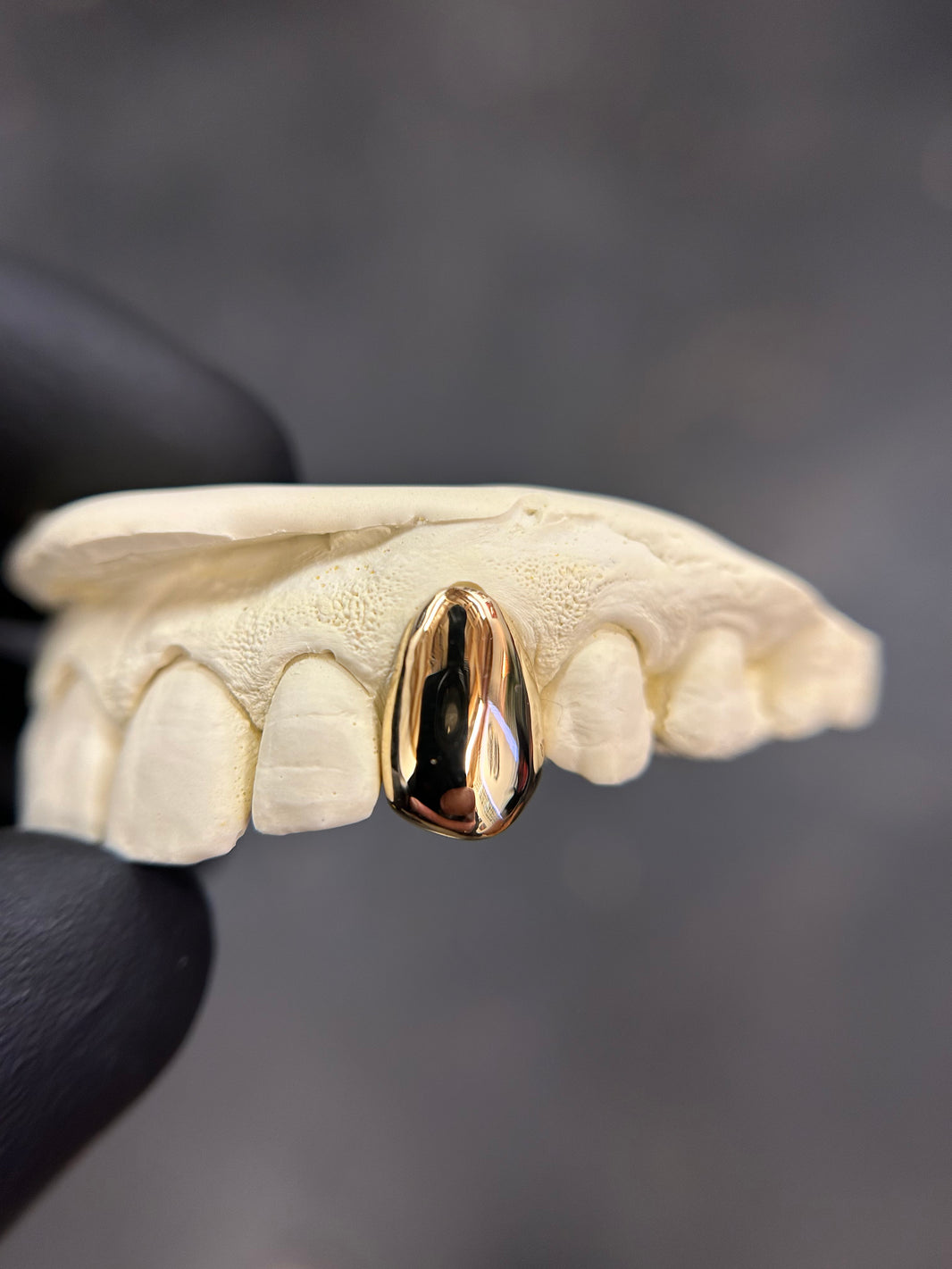 Custom Grillz London | Gold & Silver Grillz – LOUD MOUTH LDN