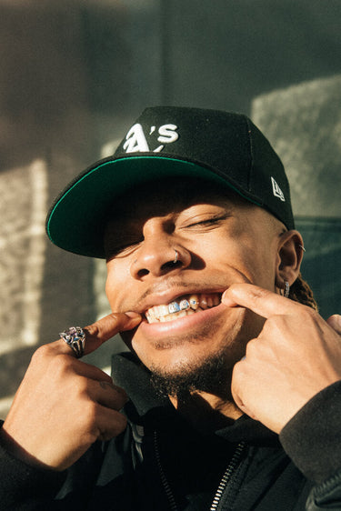 Custom Grillz London | Gold & Silver Grillz – LOUD MOUTH LDN